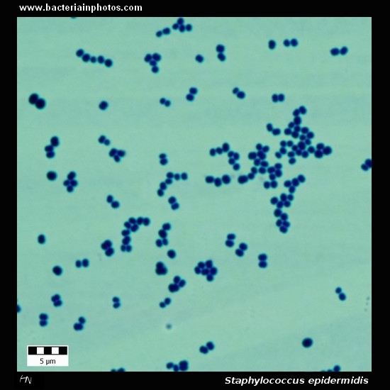 Staphylococcus Epidermidis Under Microscope Microscopy Of Gram Positive Cocci Morphology And
